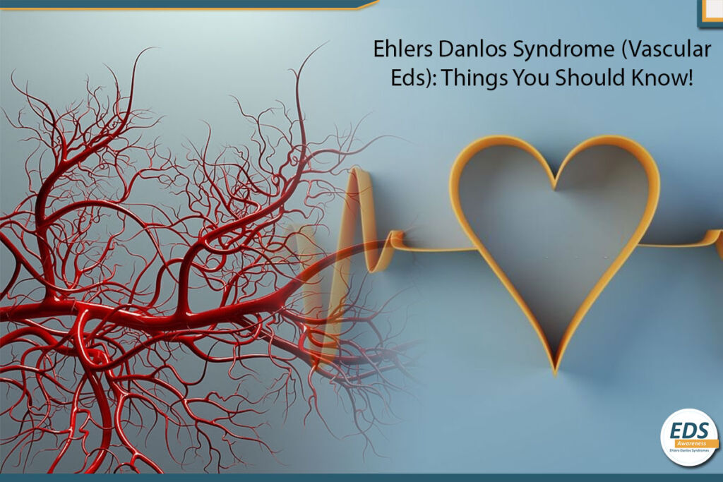 Ehlers-Danlos Syndrome (Vascular Eds): Things you should know ...